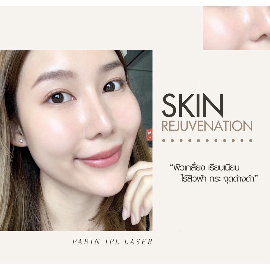 Parin SET IPL LASER & FREEZE STICK:IPL LASER+หน้าใส (พร้อมถุงผ้า) &สปา ...