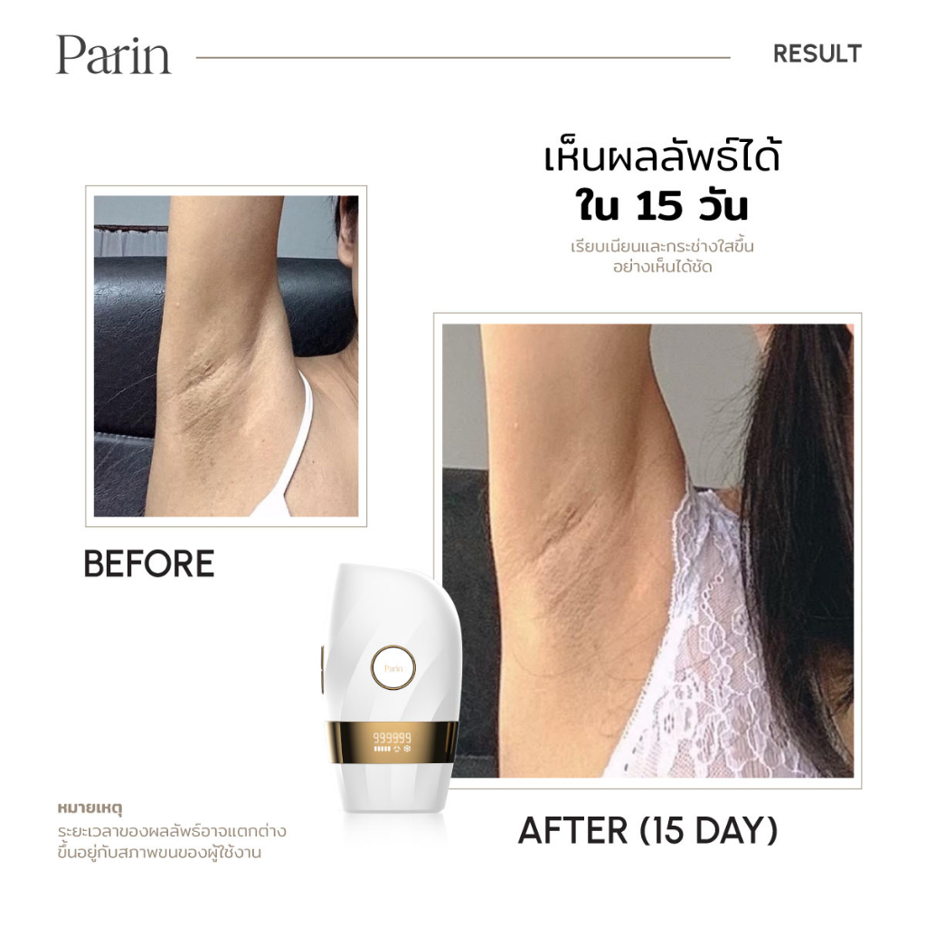 Parin IPL “ICONIC” GEN 4 เครื่องกำจัดขน&หน้าใส โหมดเลเซอร์เย็น -8 องศา ...